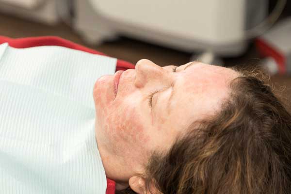 PRF | Platelet-Rich Fibrin Facial - Atlanta Periodontics